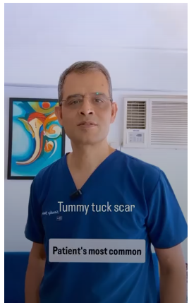 Explore the Body Lift Surgery | Our Cosmetic Surgeon